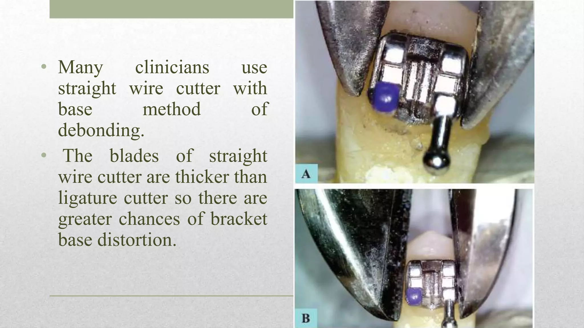 Debonding of orhtodontic brackets | PPTX