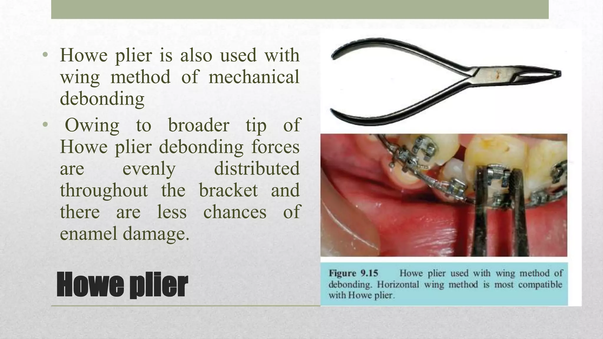 Debonding of orhtodontic brackets | PPTX