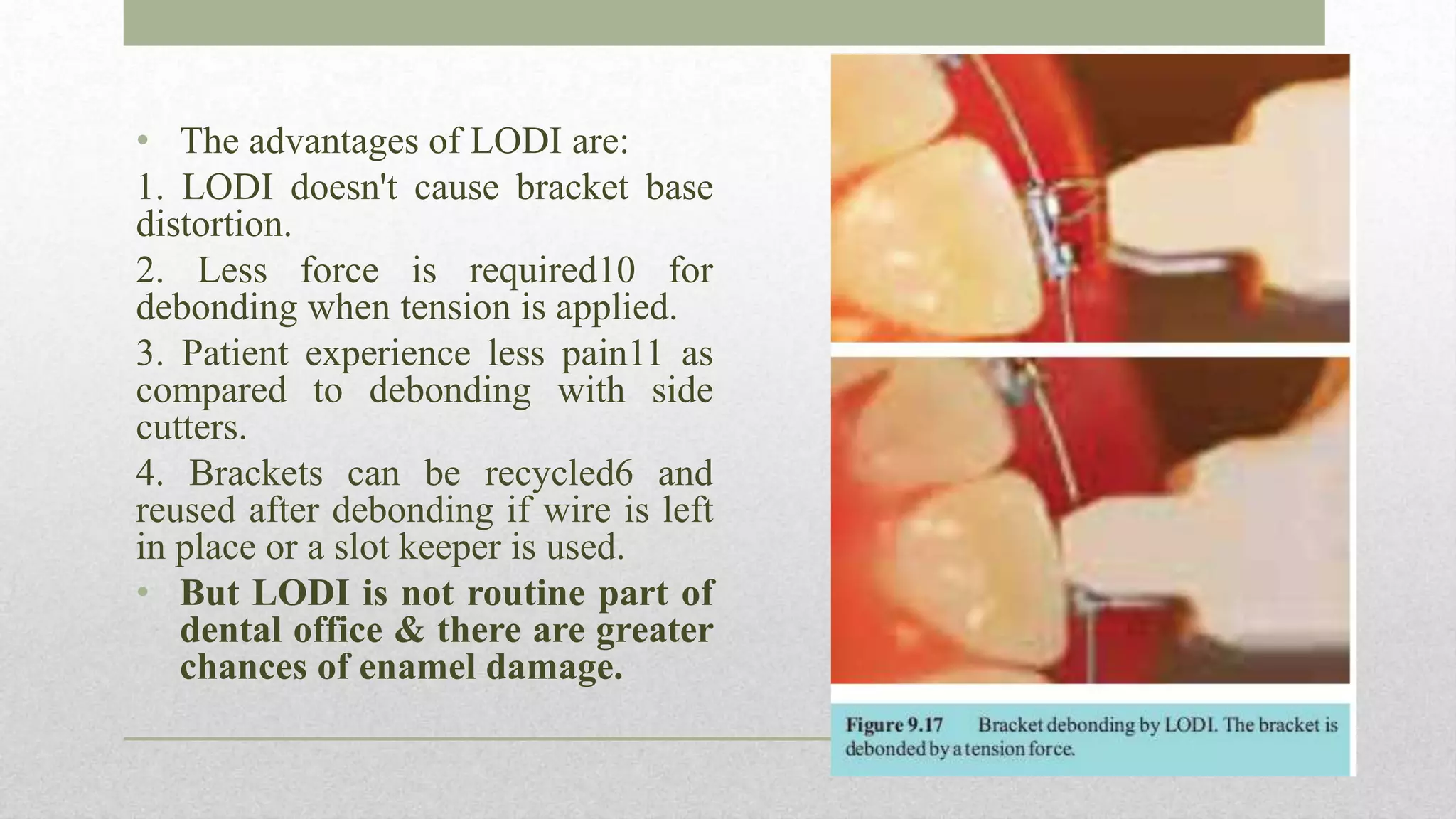 Debonding of orhtodontic brackets | PPTX