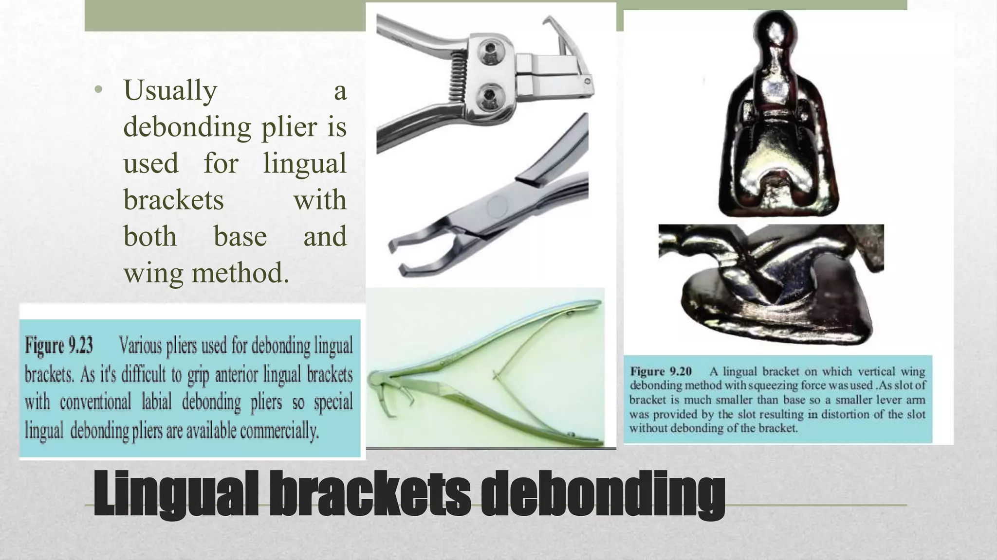 Debonding of orhtodontic brackets | PPTX