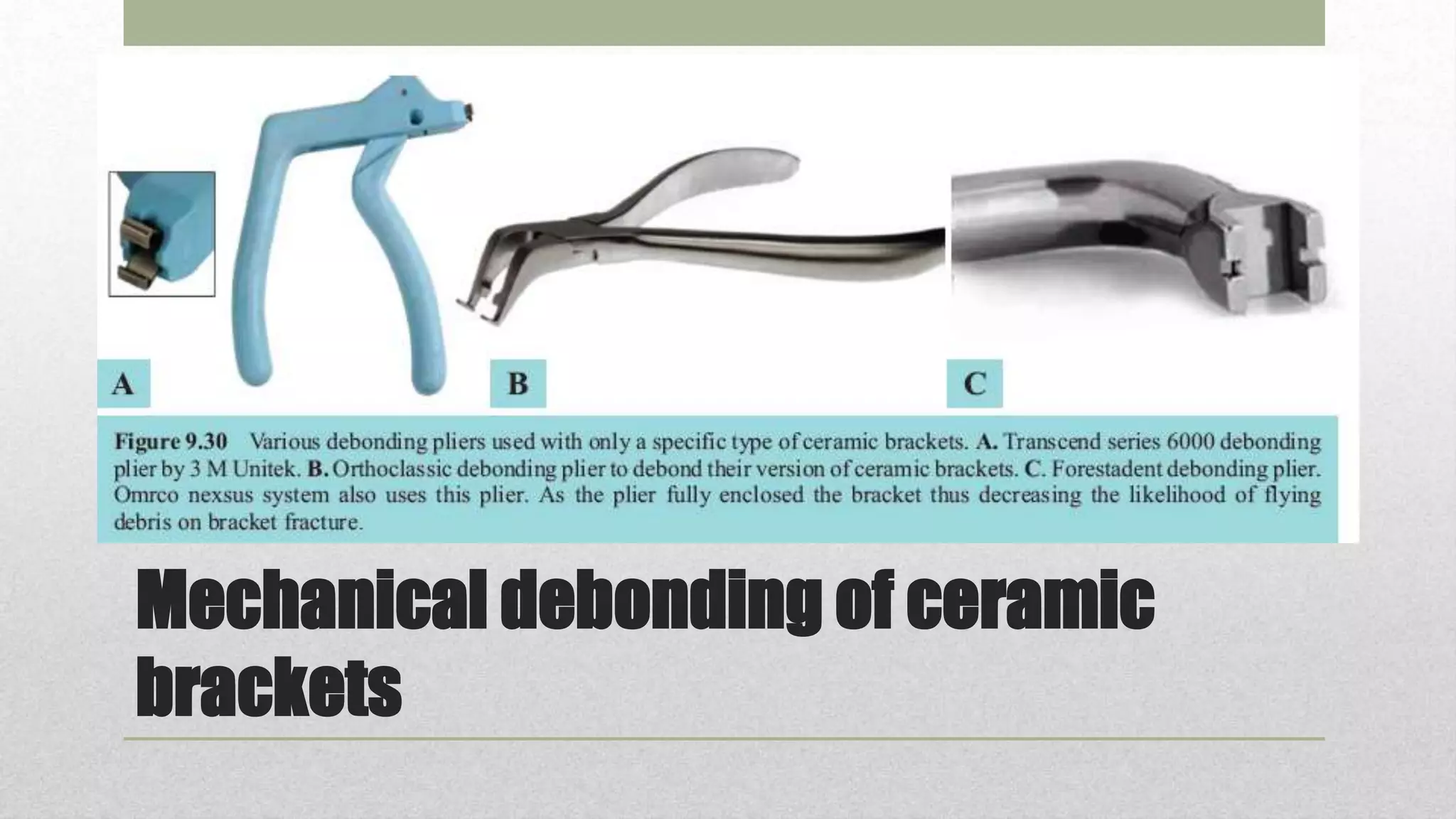 Debonding of orhtodontic brackets | PPTX