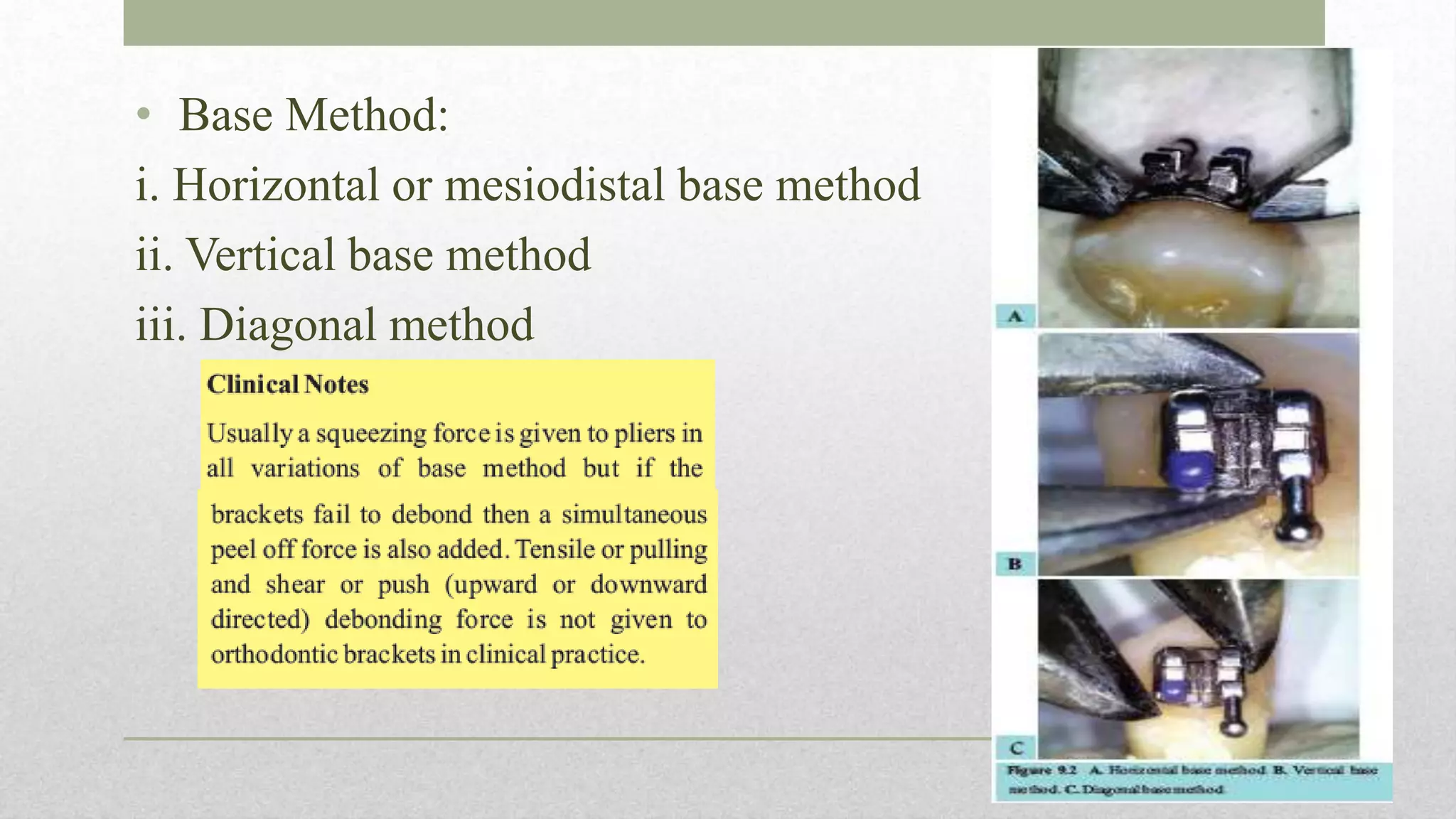 Debonding of orhtodontic brackets | PPTX