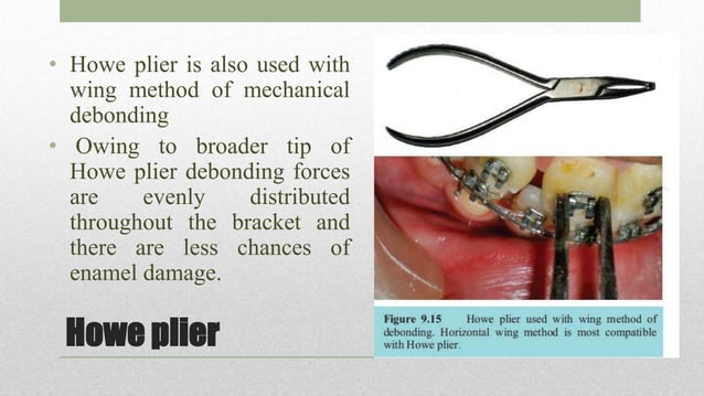 Debonding of orhtodontic brackets | PPTX | Dental Health | Diseases and ...