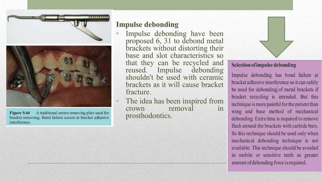 Debonding of orhtodontic brackets | PPTX | Dental Health | Diseases and ...