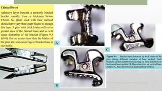 Debonding of orhtodontic brackets | PPTX