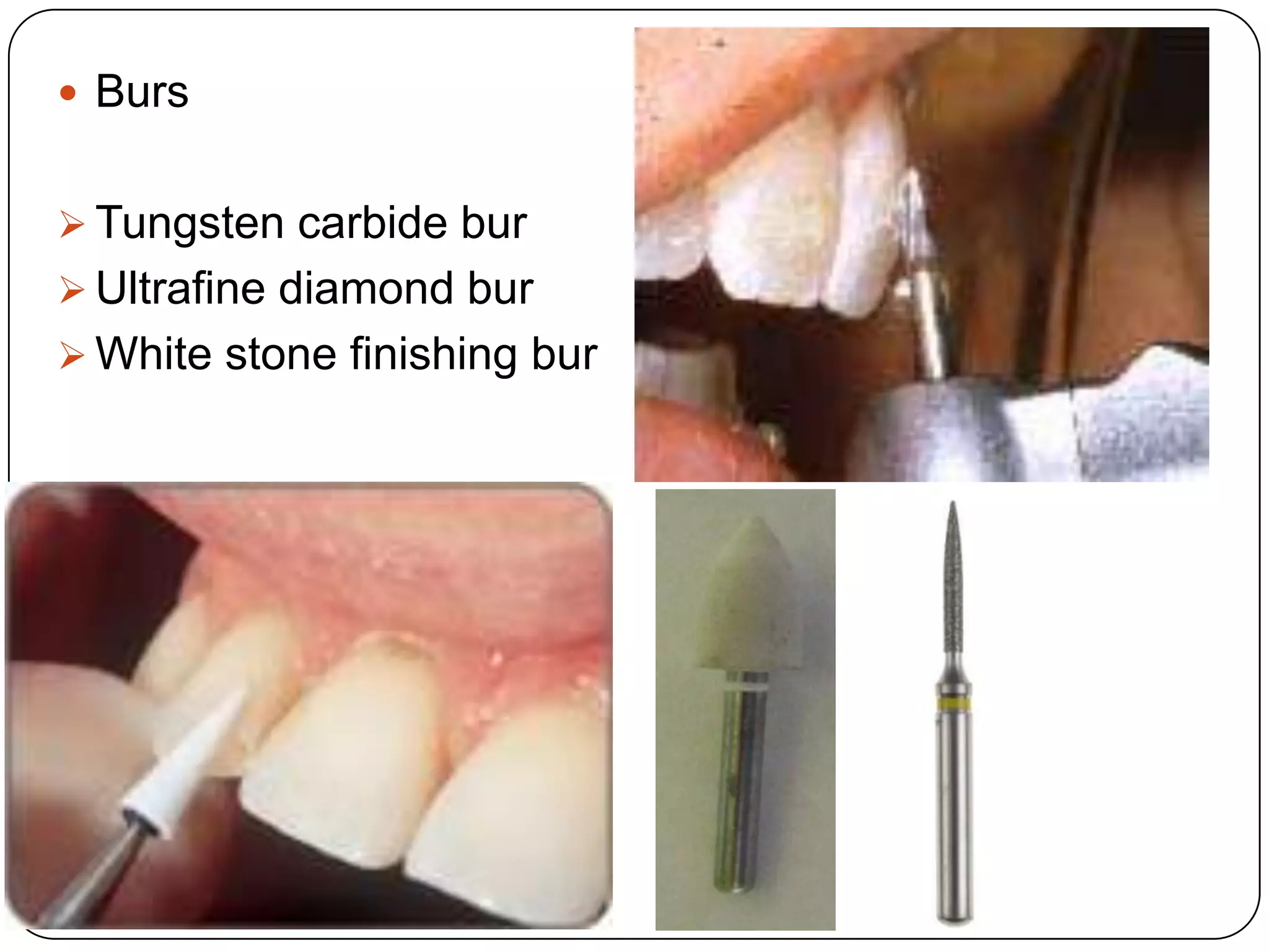Debonding procedures in orthodontics | PPTX