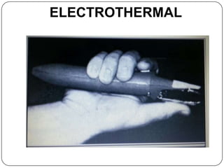 Debonding procedures in orthodontics | PPTX
