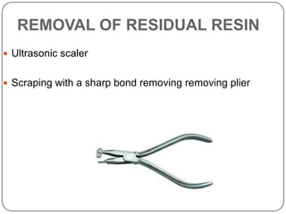 Debonding procedures in orthodontics | PPTX