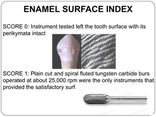 Debonding procedures in orthodontics | PPTX