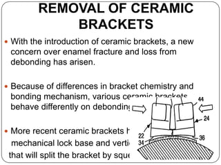 Debonding procedures in orthodontics | PPTX