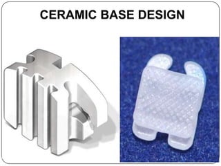 Debonding procedures in orthodontics | PPTX