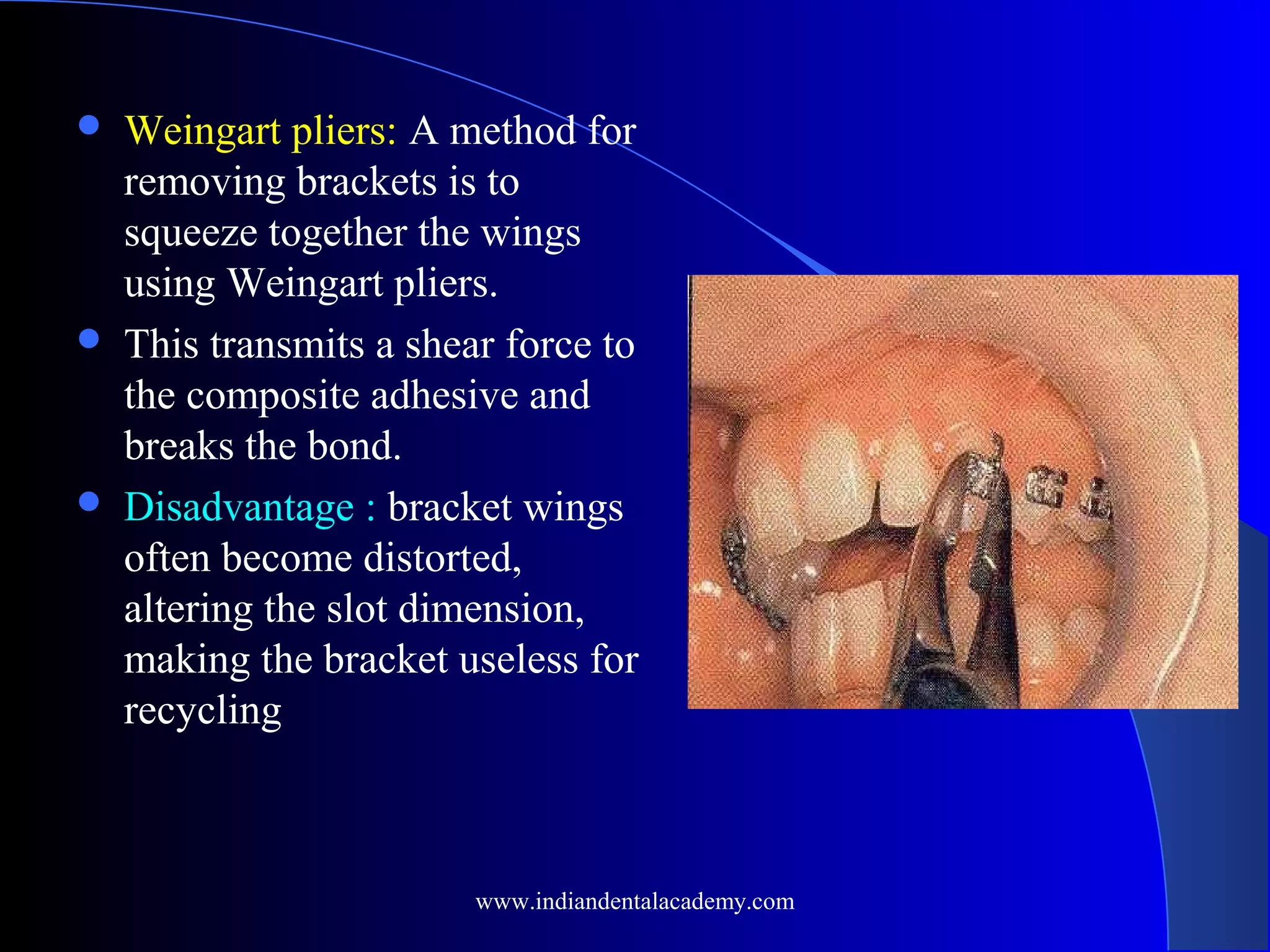 Debonding techniques and enamel fracture patterns /certified fixed ...