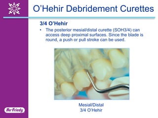 Debridement Curettes | PPT