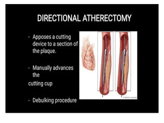 Debulking device | PPTX