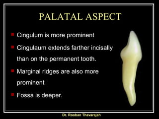Morphology of Human Deciduous Maxillary Central Incisor Tooth | PPT