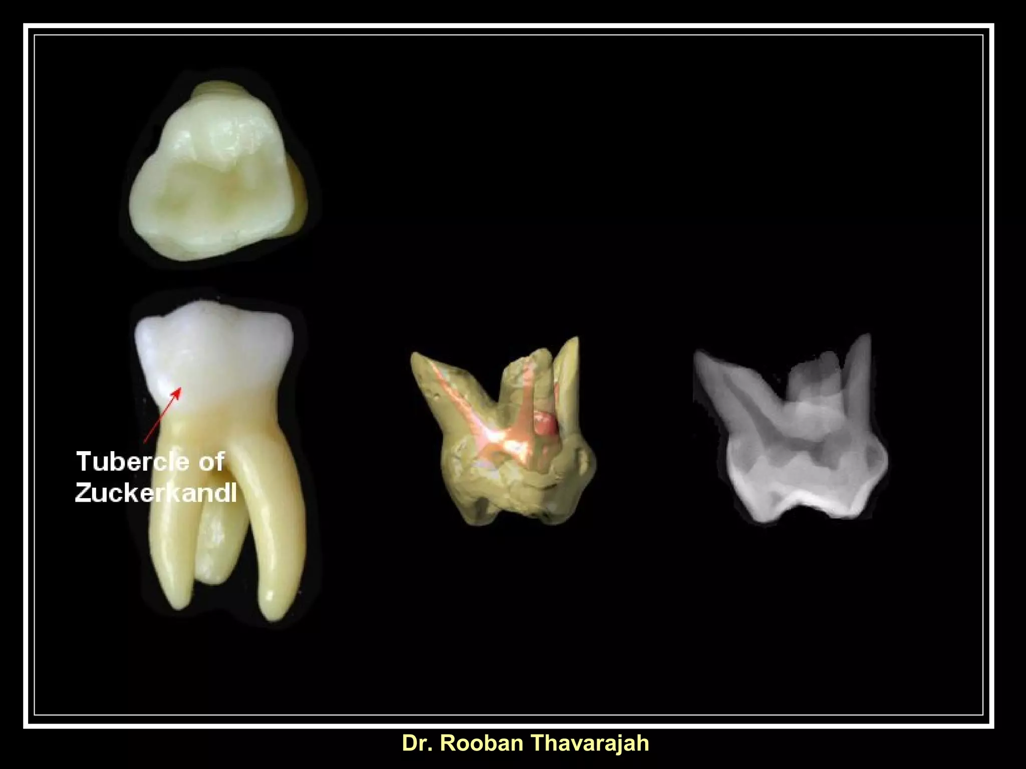 Morphology of Human Deciduous Maxillary Molar Tooth | PPT