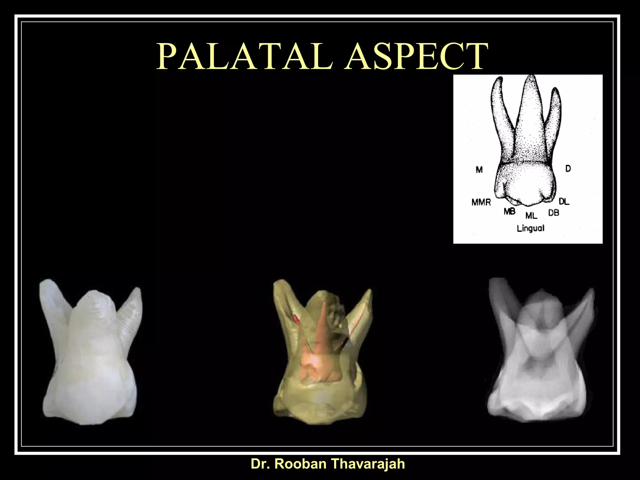 Morphology of Human Deciduous Maxillary Molar Tooth | PPT