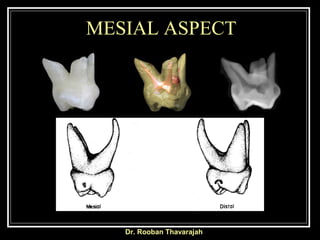 Morphology of Human Deciduous Maxillary Molar Tooth | PPT