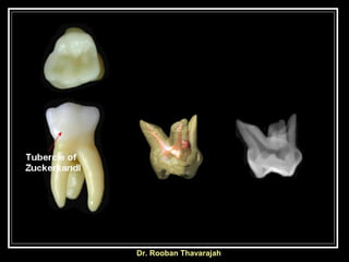 Morphology of Human Deciduous Maxillary Molar Tooth | PPT
