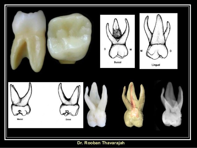 Morphology of Human Deciduous Maxillary Molar Tooth