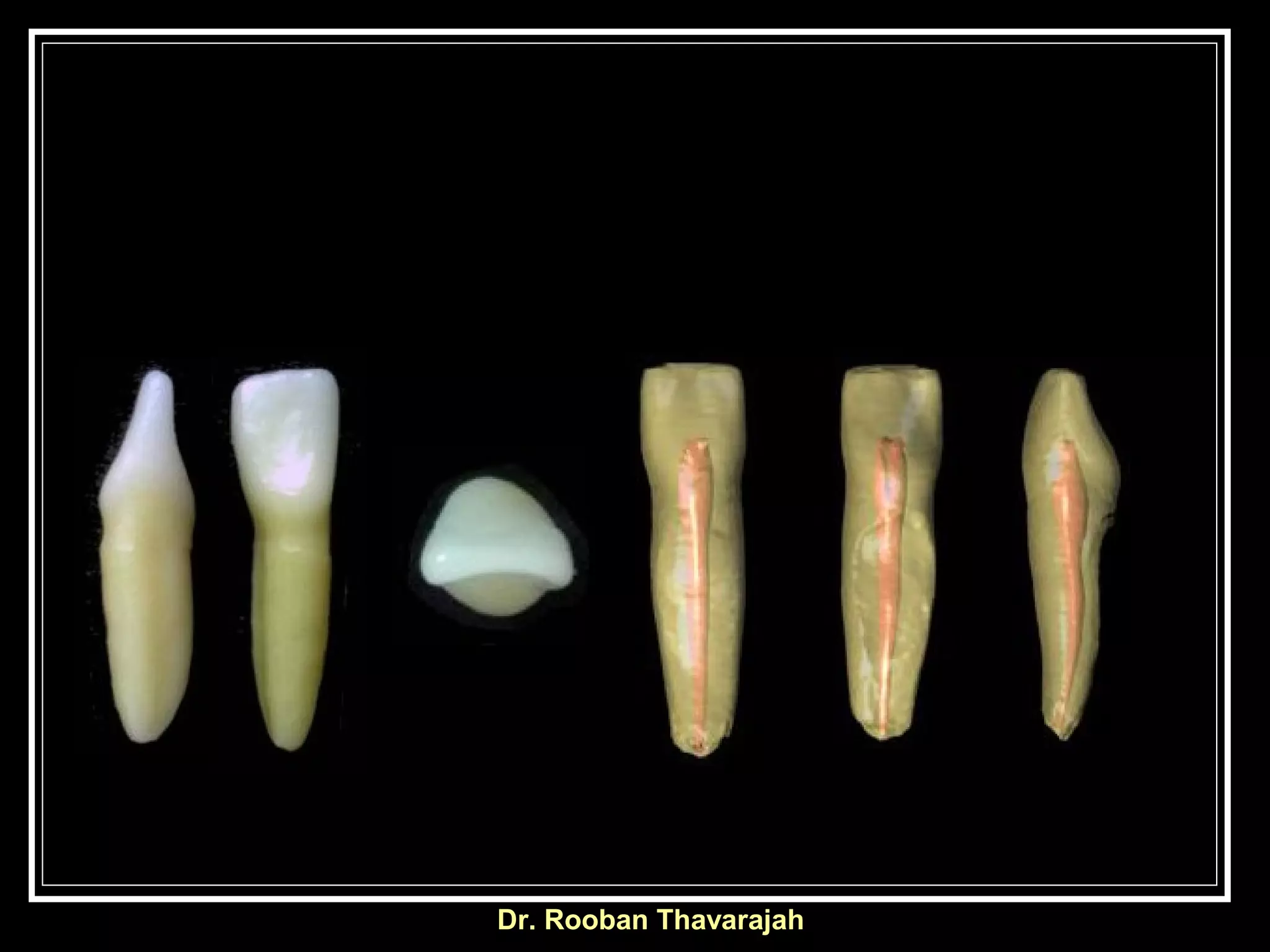 Morphology of Human Deciduous Mandibular Central Incisor Tooth | PPT