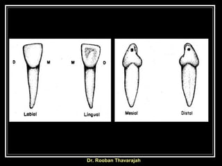 Morphology of Human Deciduous Mandibular Central Incisor Tooth | PPT