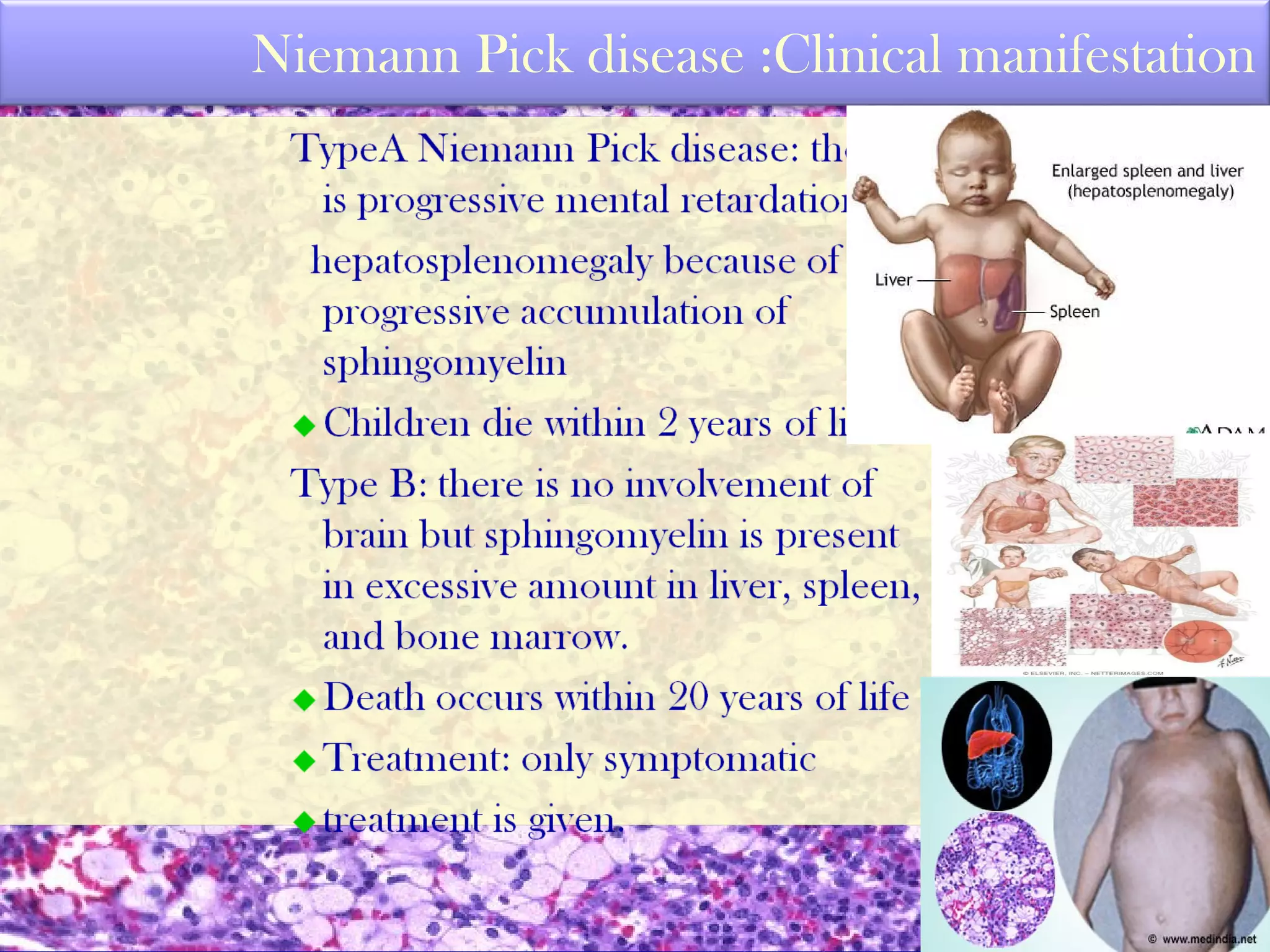 LIPID STORAGE DISEASES MUHAMMAD MUSTANSAR FJMC LAHORE | PPT | Brain and ...