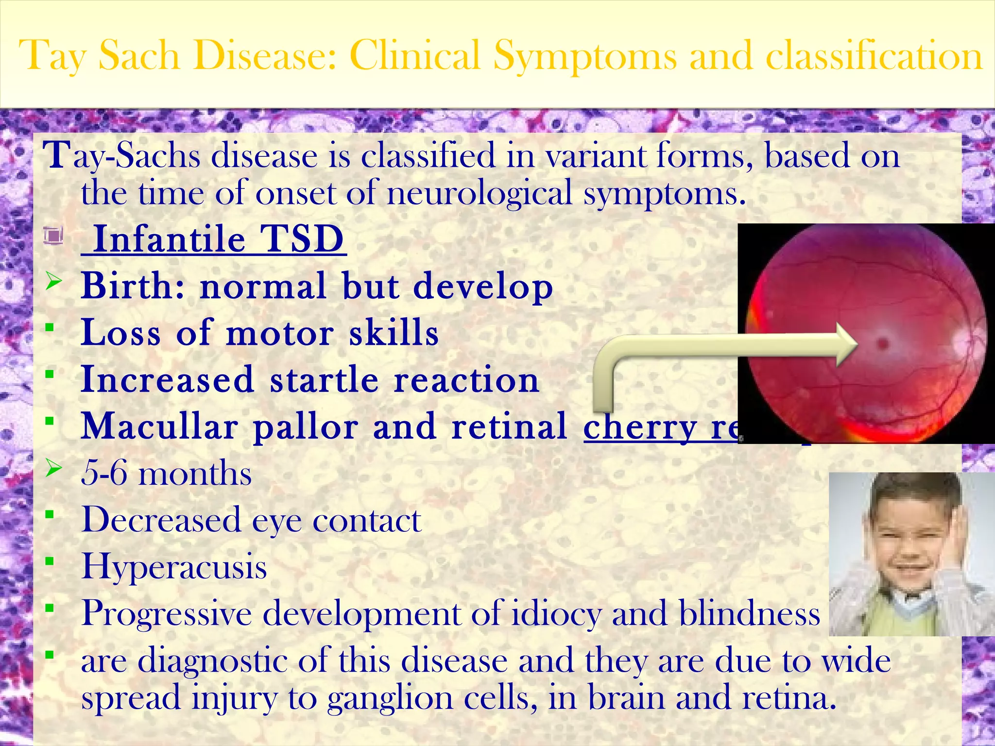 LIPID STORAGE DISEASES MUHAMMAD MUSTANSAR FJMC LAHORE | PPT | Brain and ...