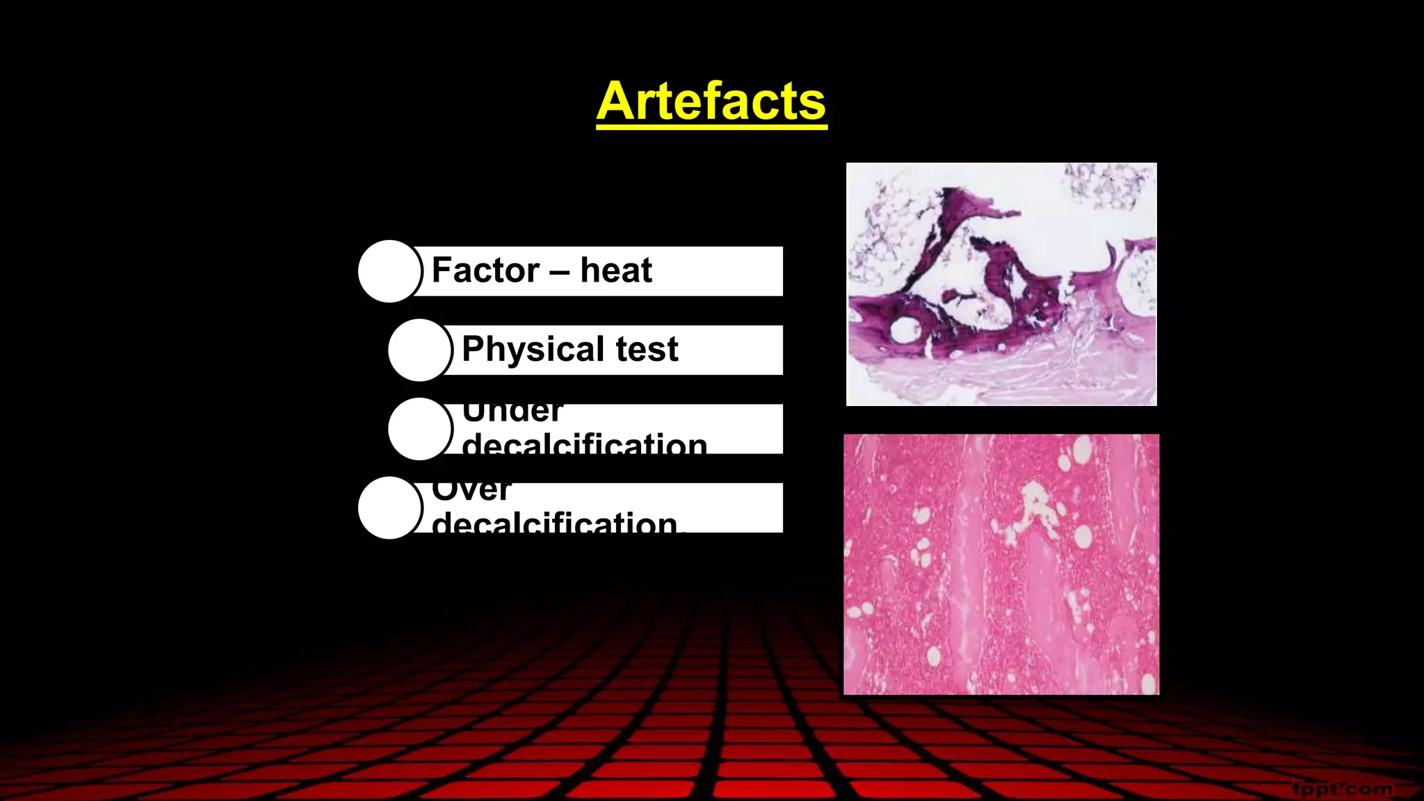 Decalcification of bone and tooth | PPT