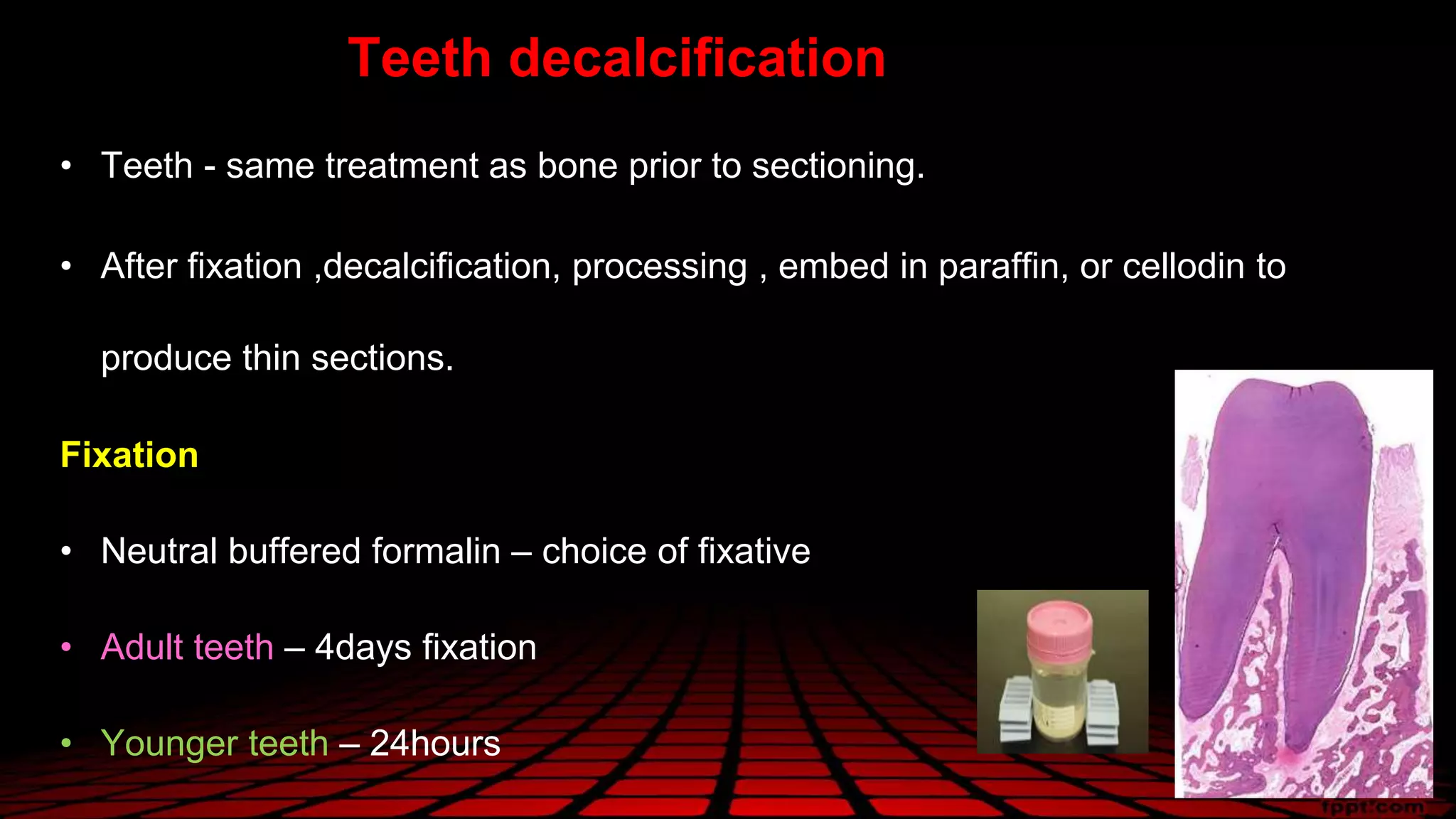 Decalcification of bone and tooth | PPT