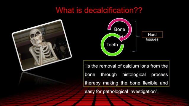 Decalcification of bone and tooth | PPT | Chemistry | Science