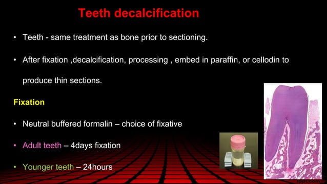 Decalcification of bone and tooth | PPT | Chemistry | Science
