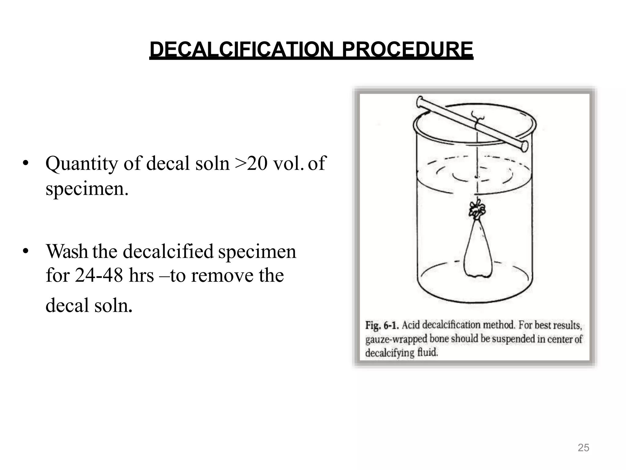 decalcification.pdf
