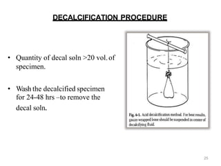 decalcification.pdf