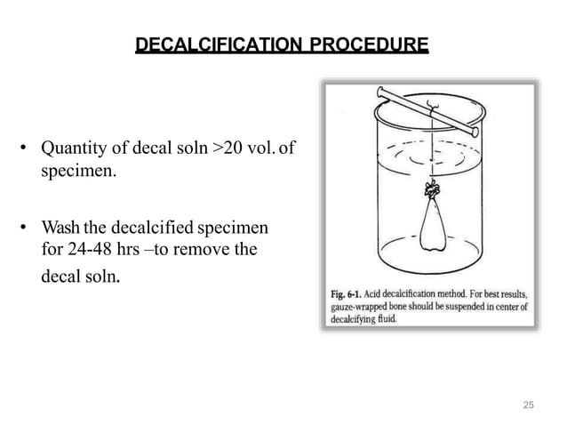 decalcification.pdf