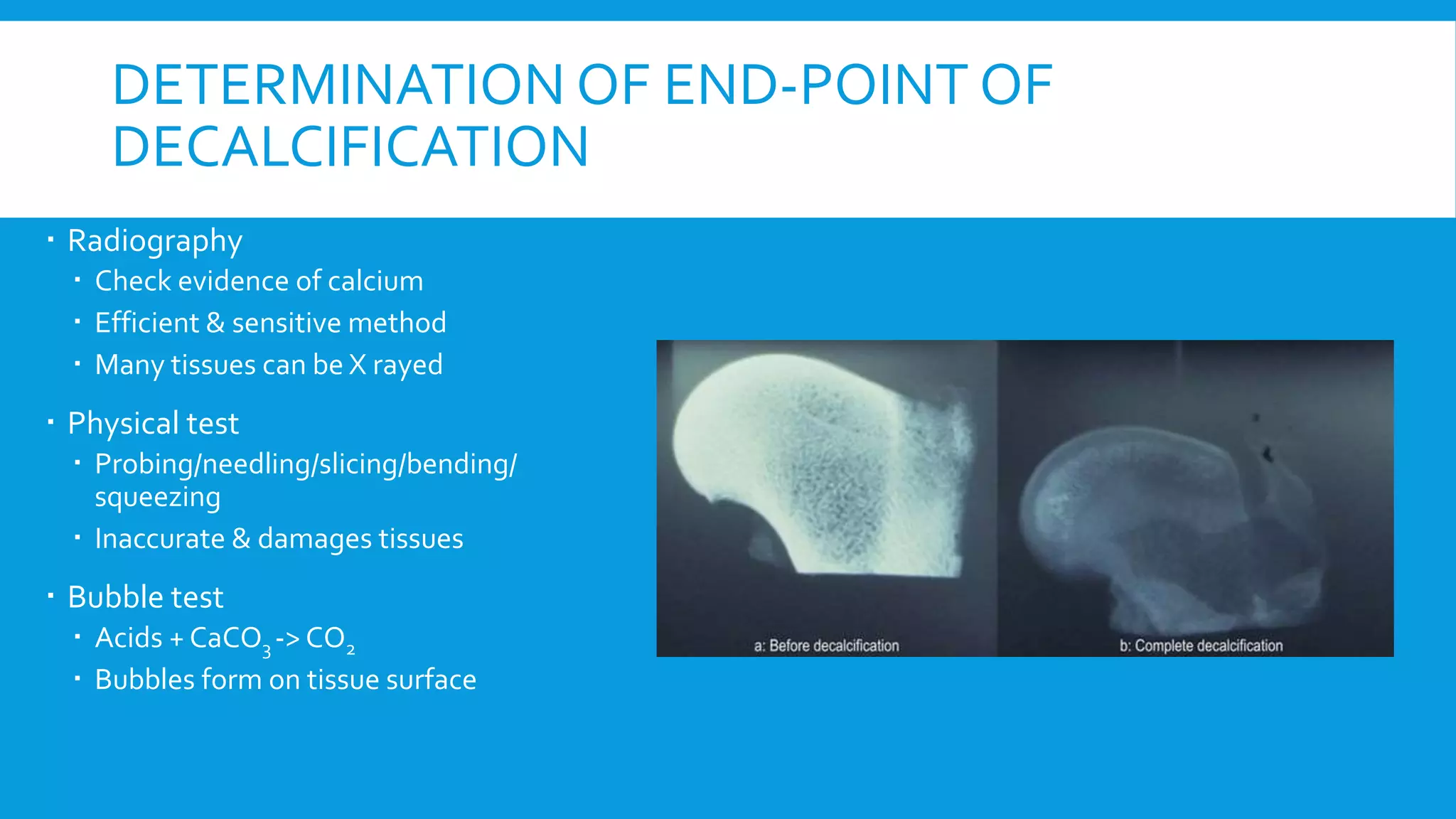 Decalcification.pptx