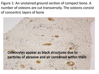 DECALCIFICATION what it is and how to cause it.pptx