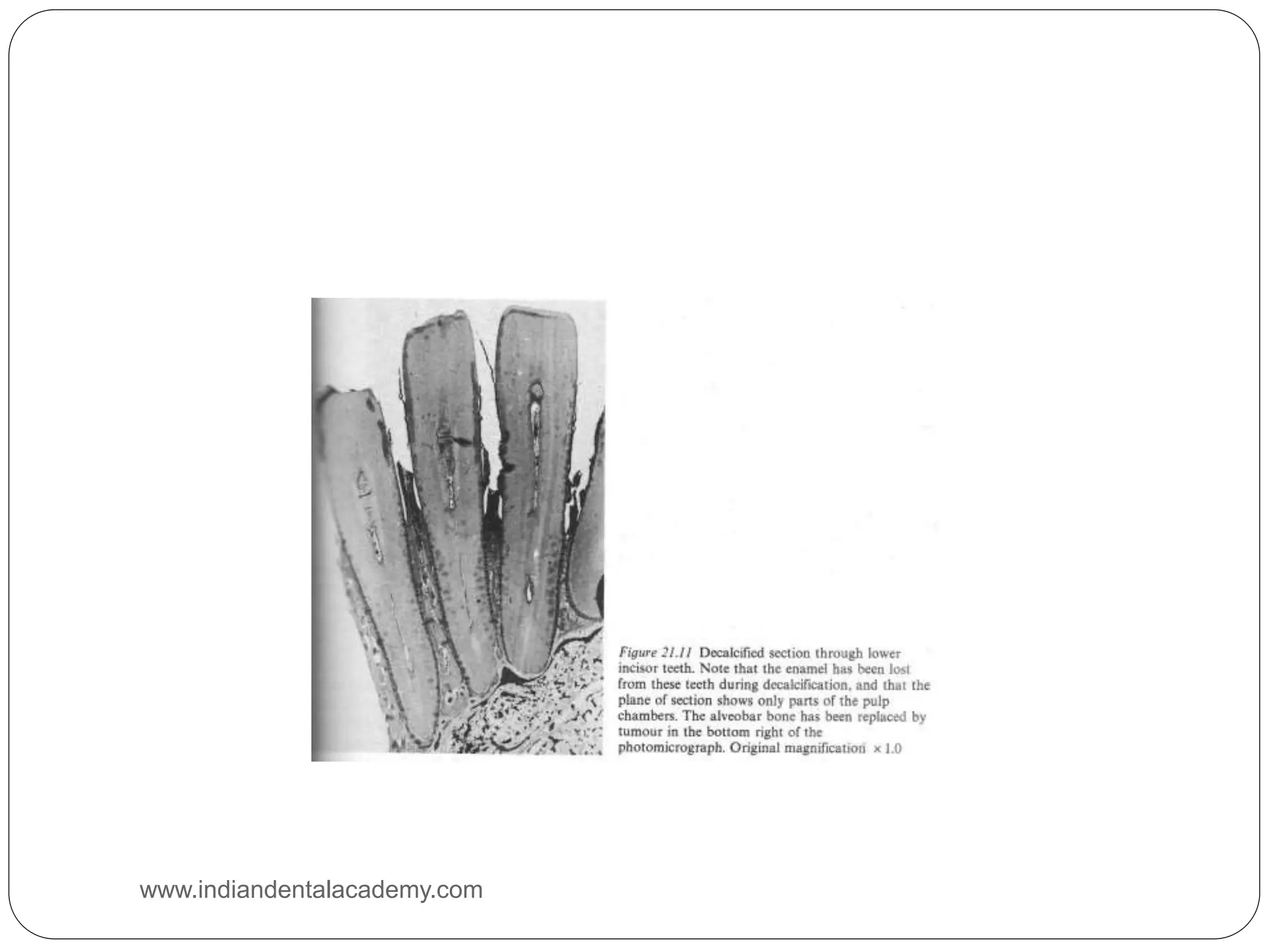 DECALCIFICATION AND PREPARATION OF GROUND SECTION OF TEETH /certified ...