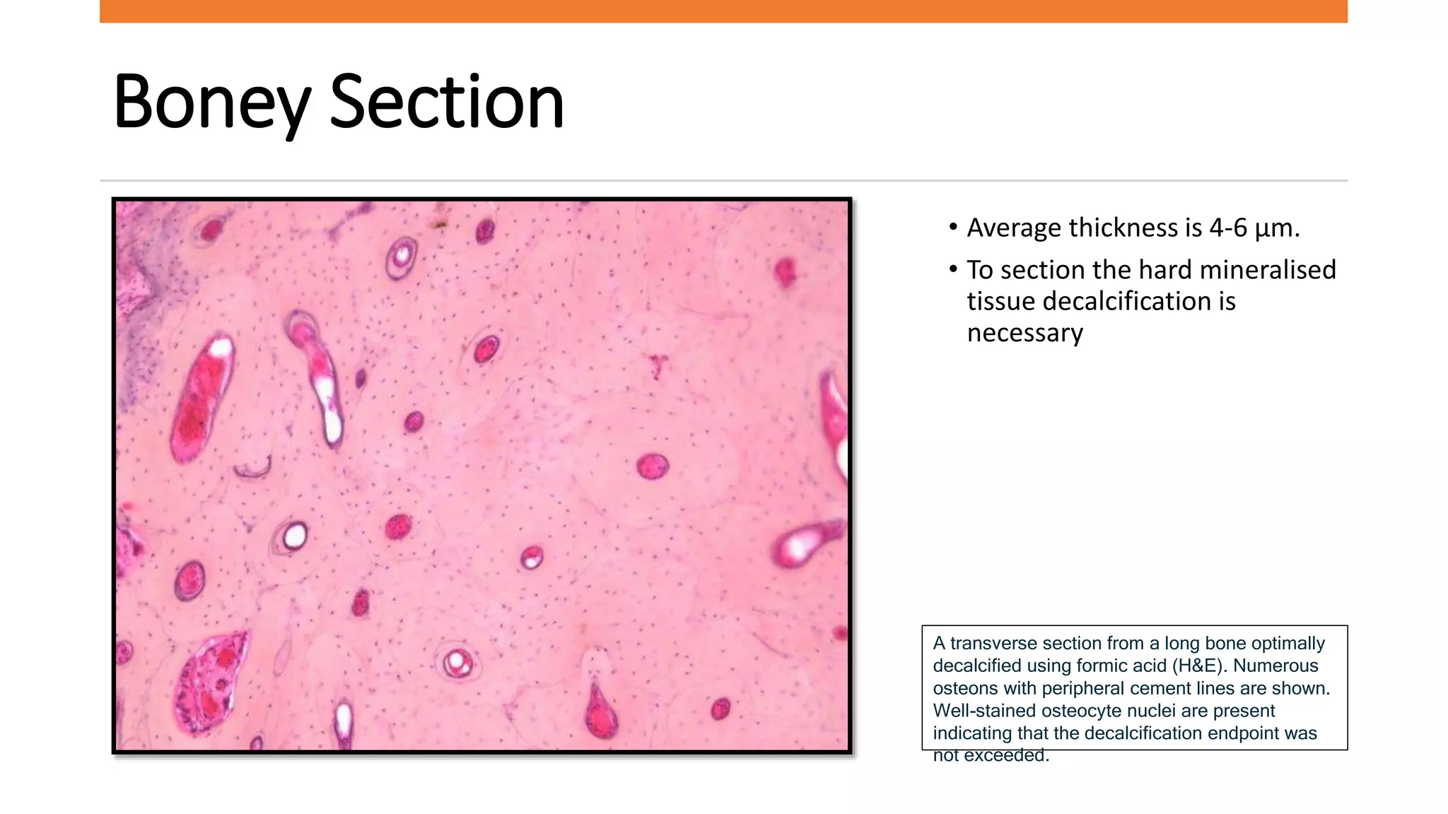 Decalcification in Histopathology.pptx