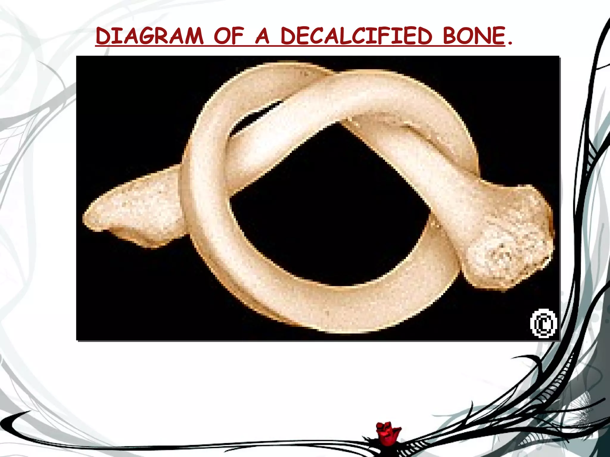 Decalcification of bone | PPT