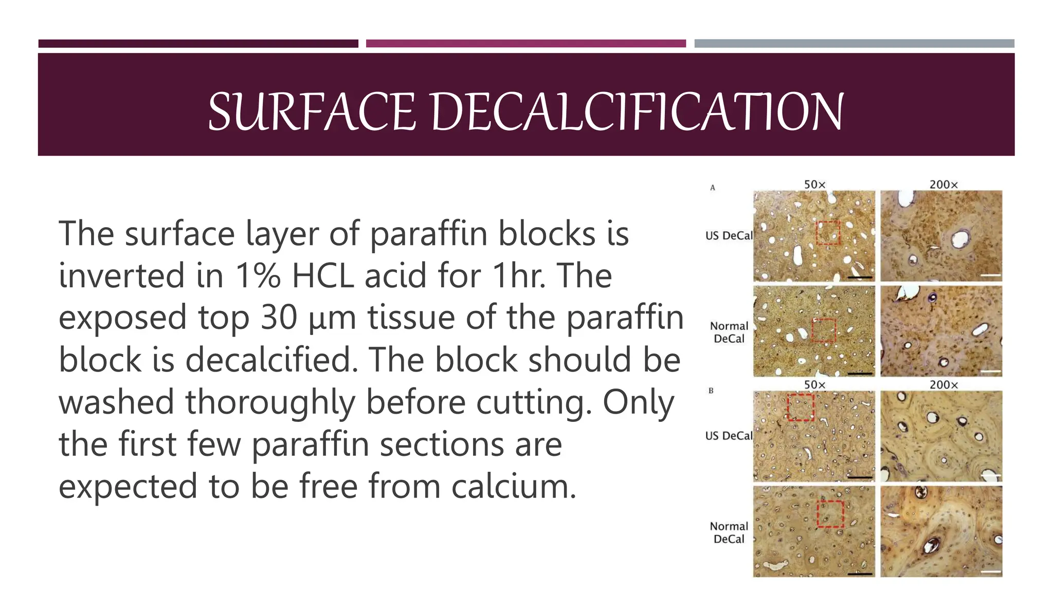Decalcification of tissue in laboratory.pptx