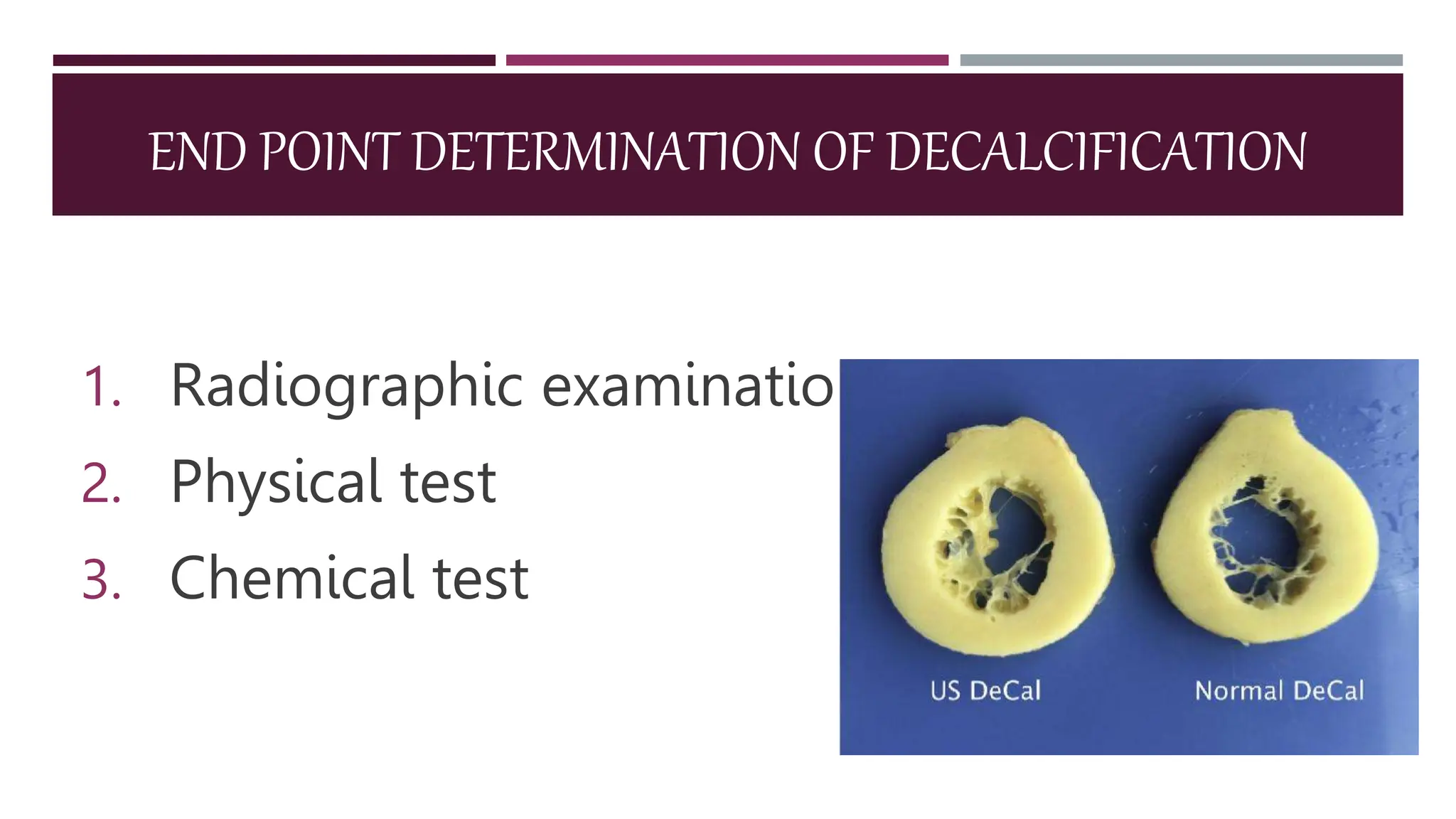 Decalcification of tissue in laboratory.pptx