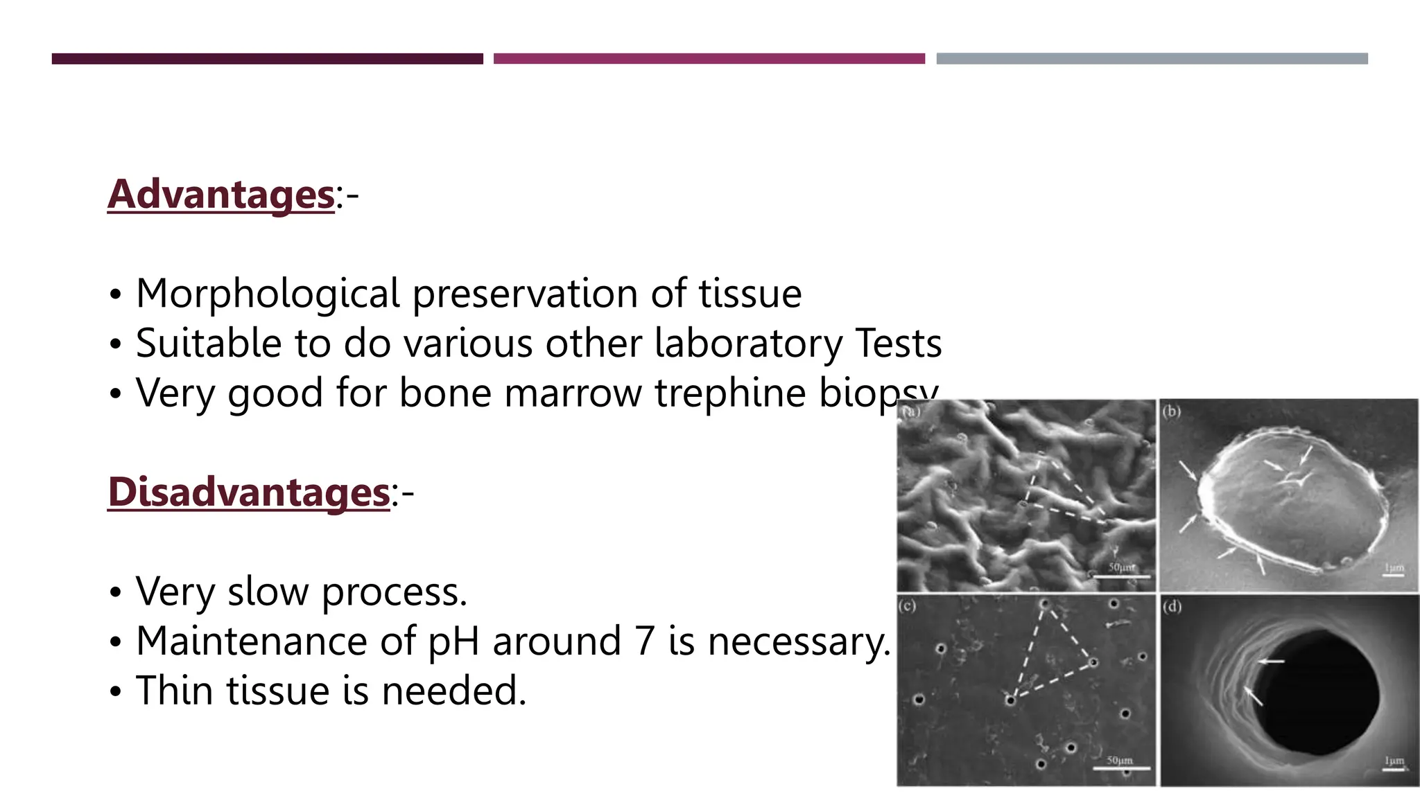 Decalcification of tissue in laboratory.pptx