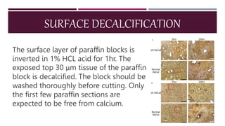 Decalcification of tissue in laboratory.pptx