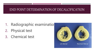 Decalcification of tissue in laboratory.pptx