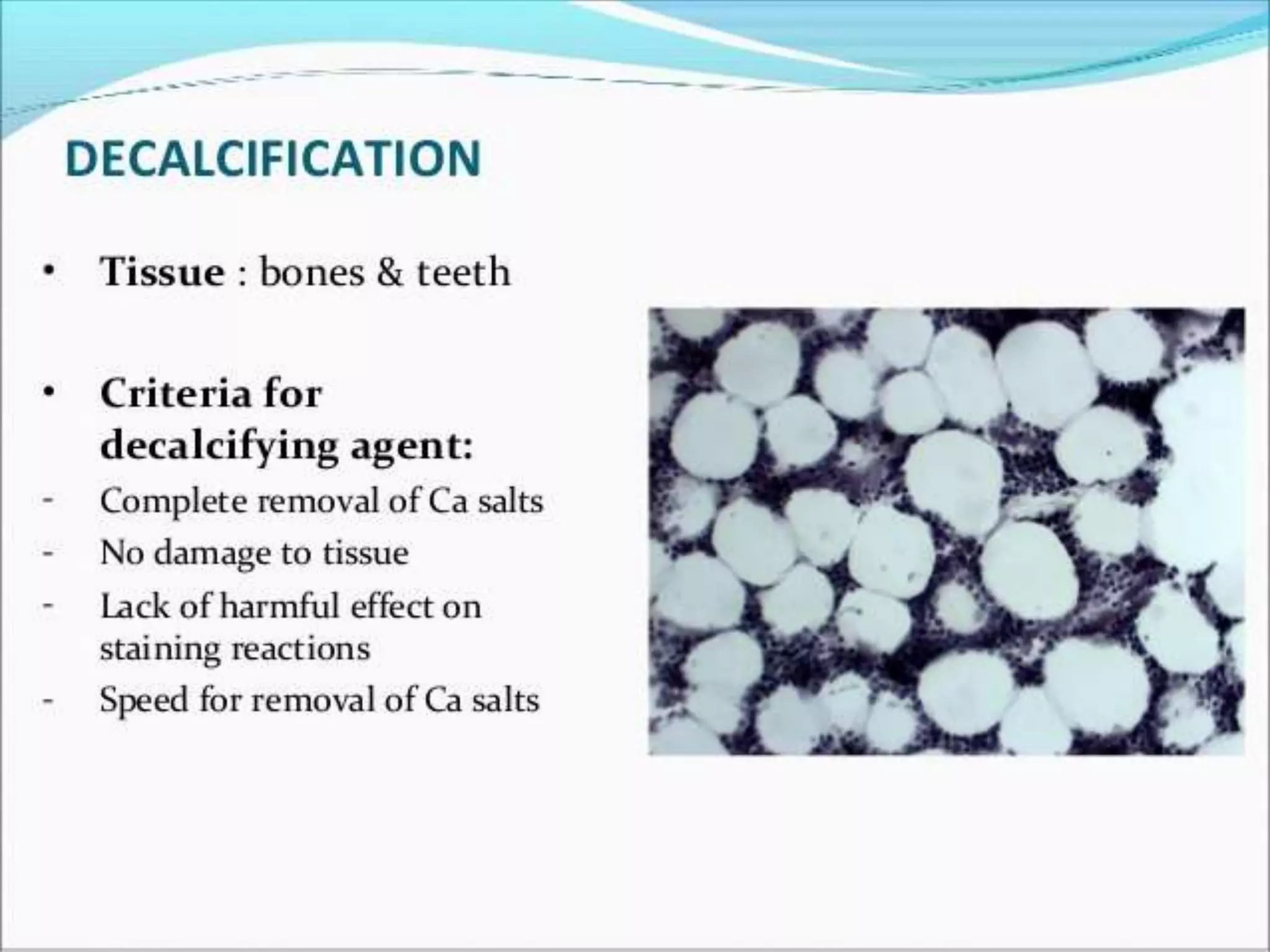 Decalcified section | PPTX