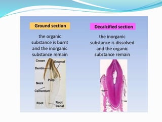 Decalcified section | PPTX
