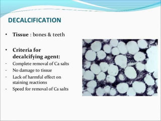 Decalcified section | PPTX