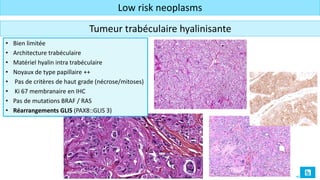Nouvelle classification OMS 2022 des tumeurs thyroïdiennes | PDF