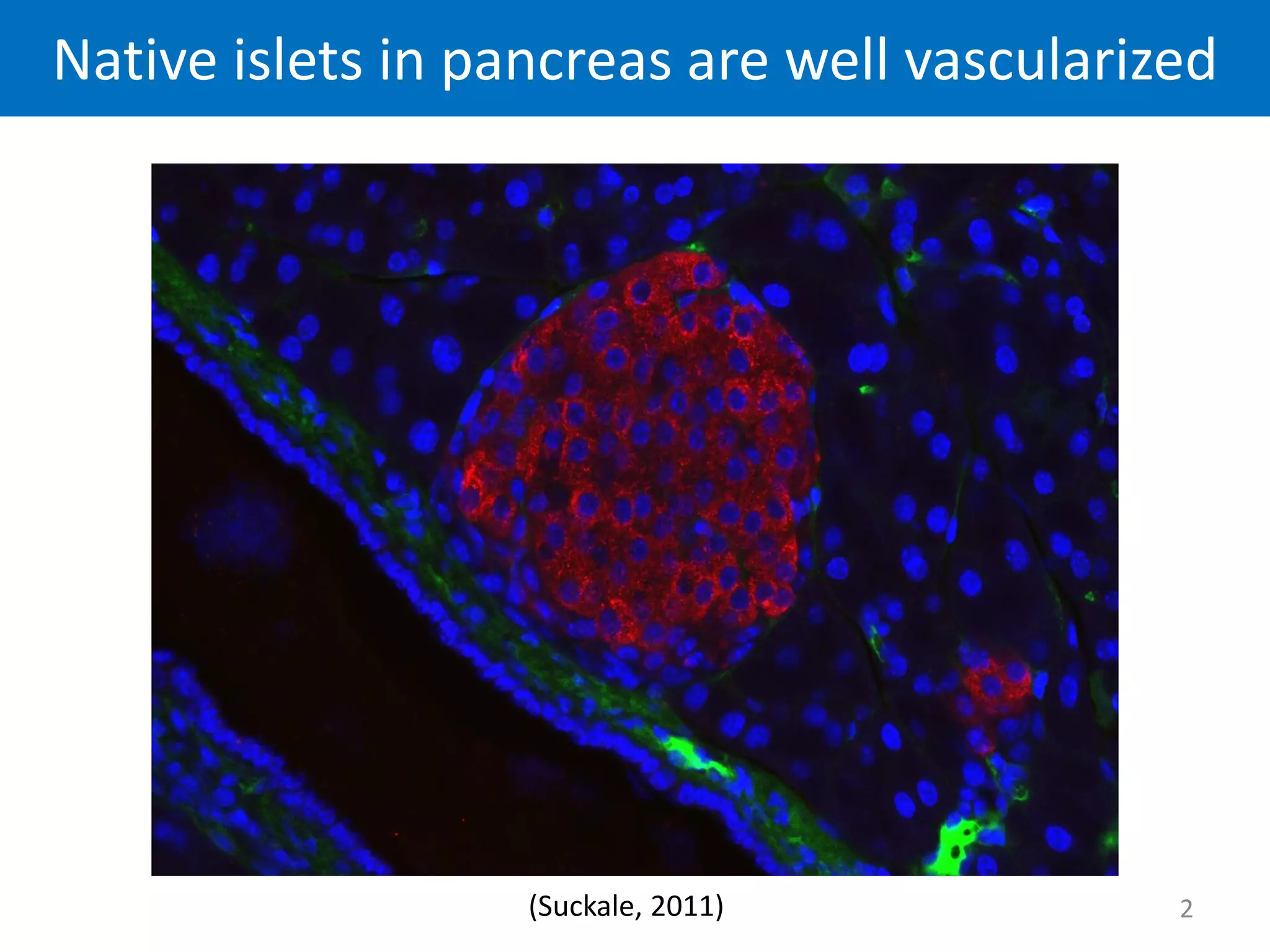 Oxygen Transfer Model and Microfluidic Encapsulation of Islets | PPT